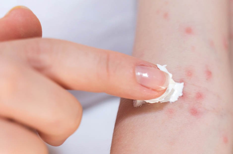 5 Stages of Allergic Reaction - Piethis